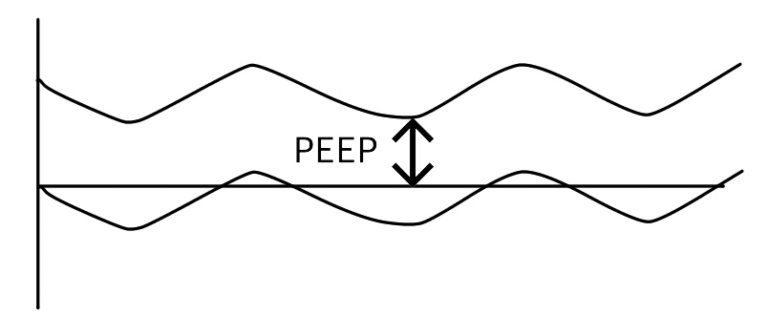 NPPVのモードの基本｜CPAPモードの特徴や適応を知る | キカイガキライ